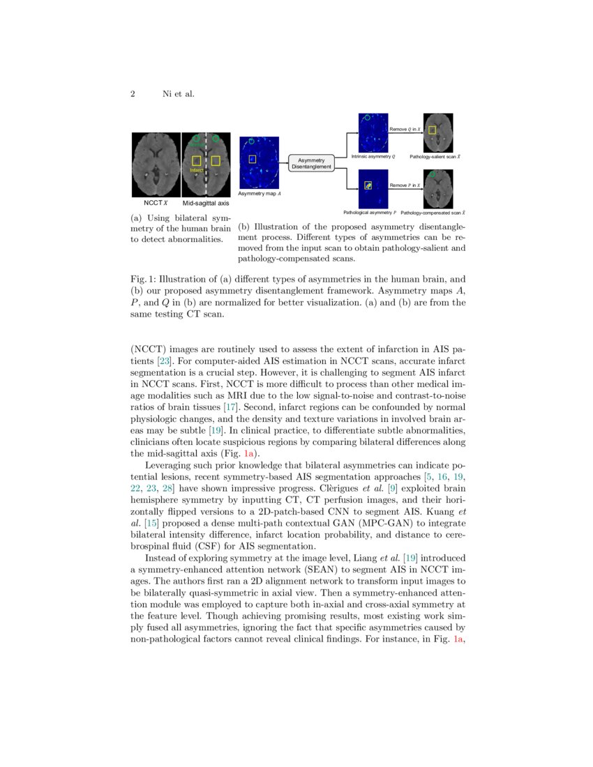 Asymmetry Disentanglement Network For Interpretable Acute Ischemic Stroke Infarct Segmentation