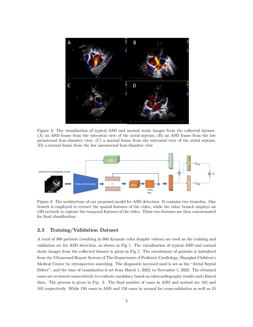 Atrial Septal Defect Detection in Children Based on Ultrasound Video Using Multiple Instances ...