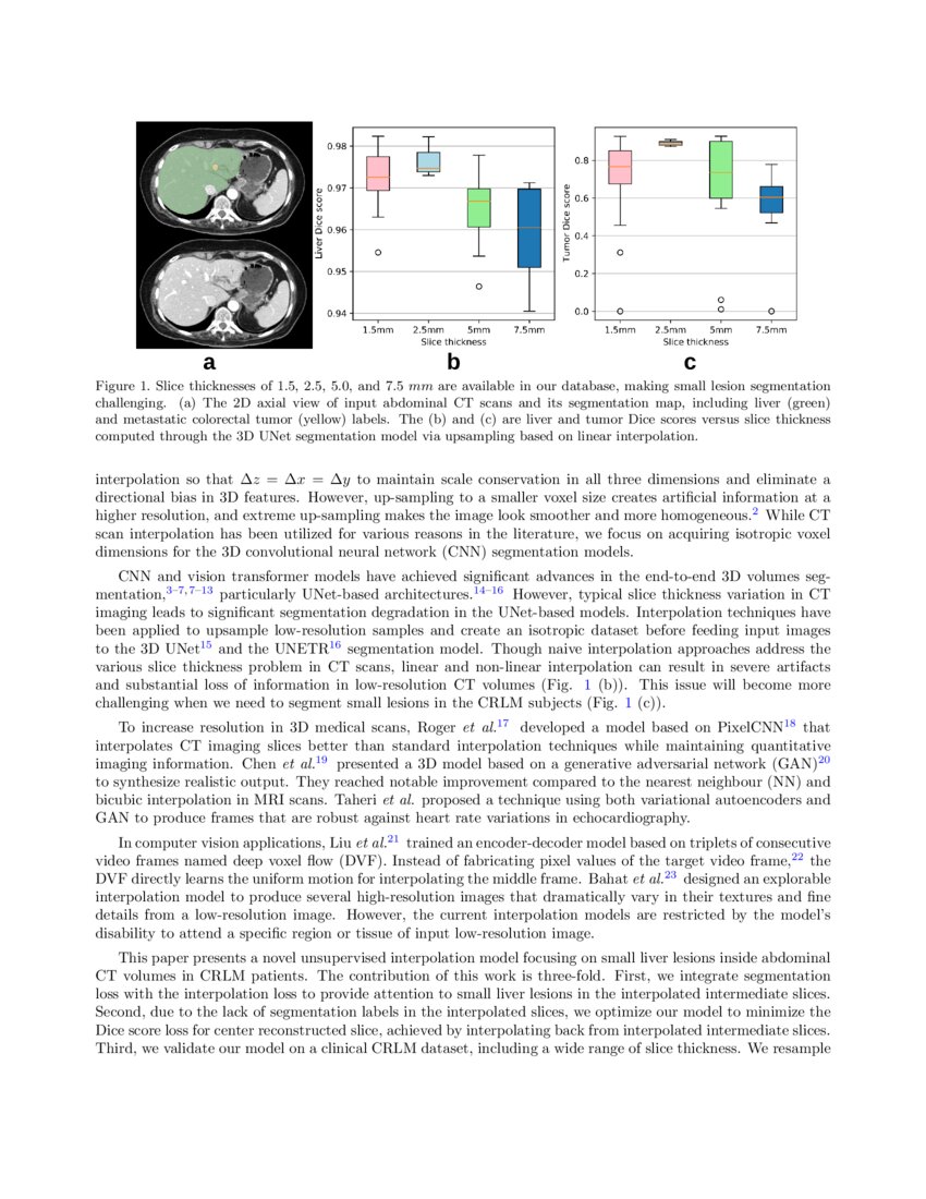 Attention Based Ct Scan Interpolation For Lesion Segmentation Of Colorectal Liver Metastases