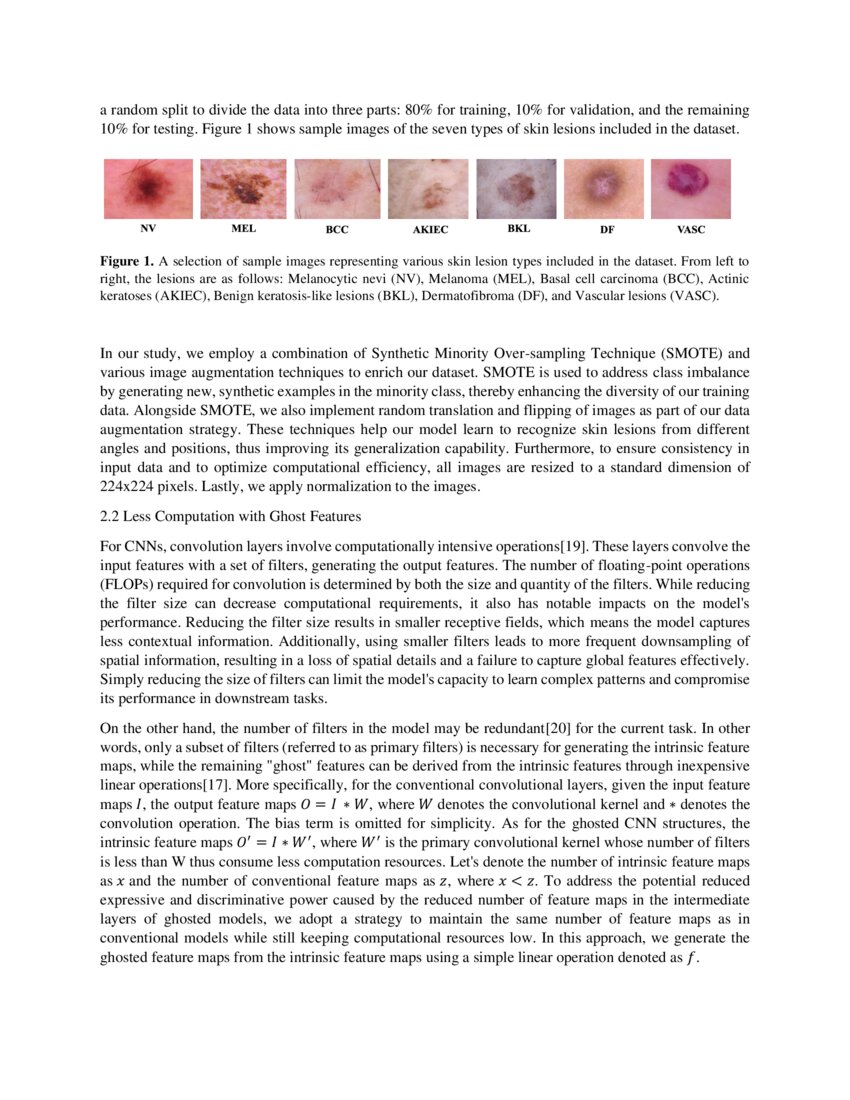 Attention-Driven Lightweight Model for Pigmented Skin Lesion Detection ...