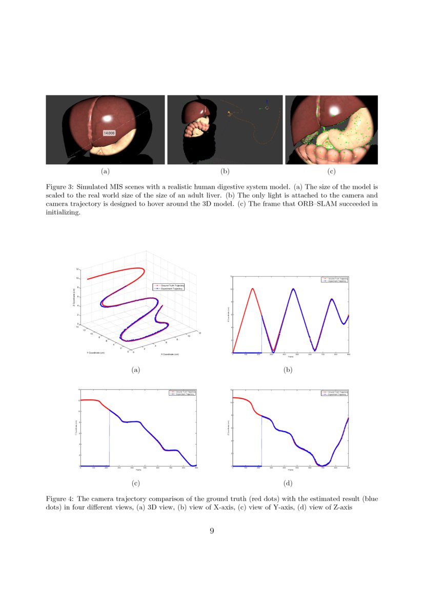 Augmented Reality for Depth Cues in Monocular Minimally Invasive ...
