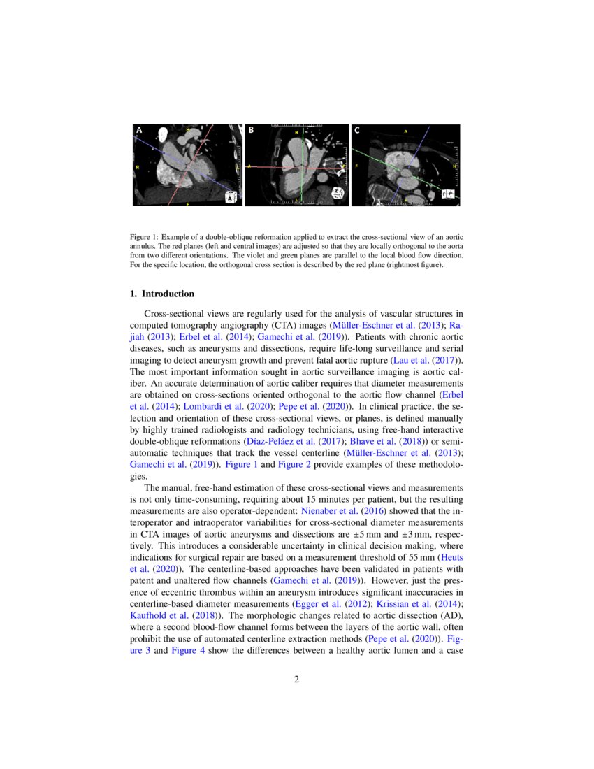 Automated cross-sectional view selection in CT angiography of aortic ...