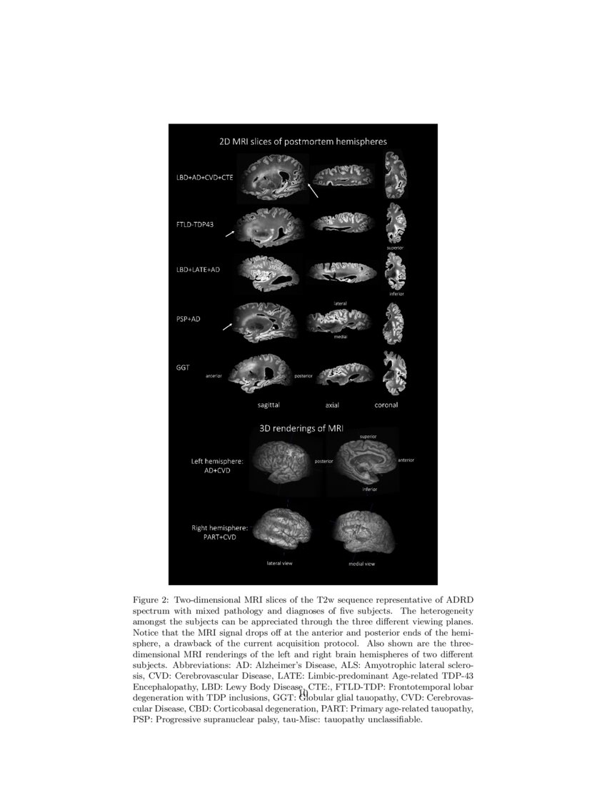 Automated deep learning segmentation of high-resolution 7 T ex vivo MRI ...