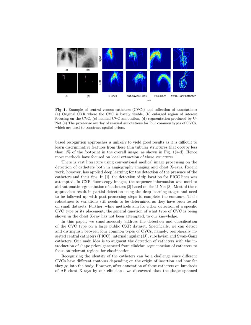 Automated Detection and Type Classification of Central Venous Catheters in Chest X-Rays | DeepAI