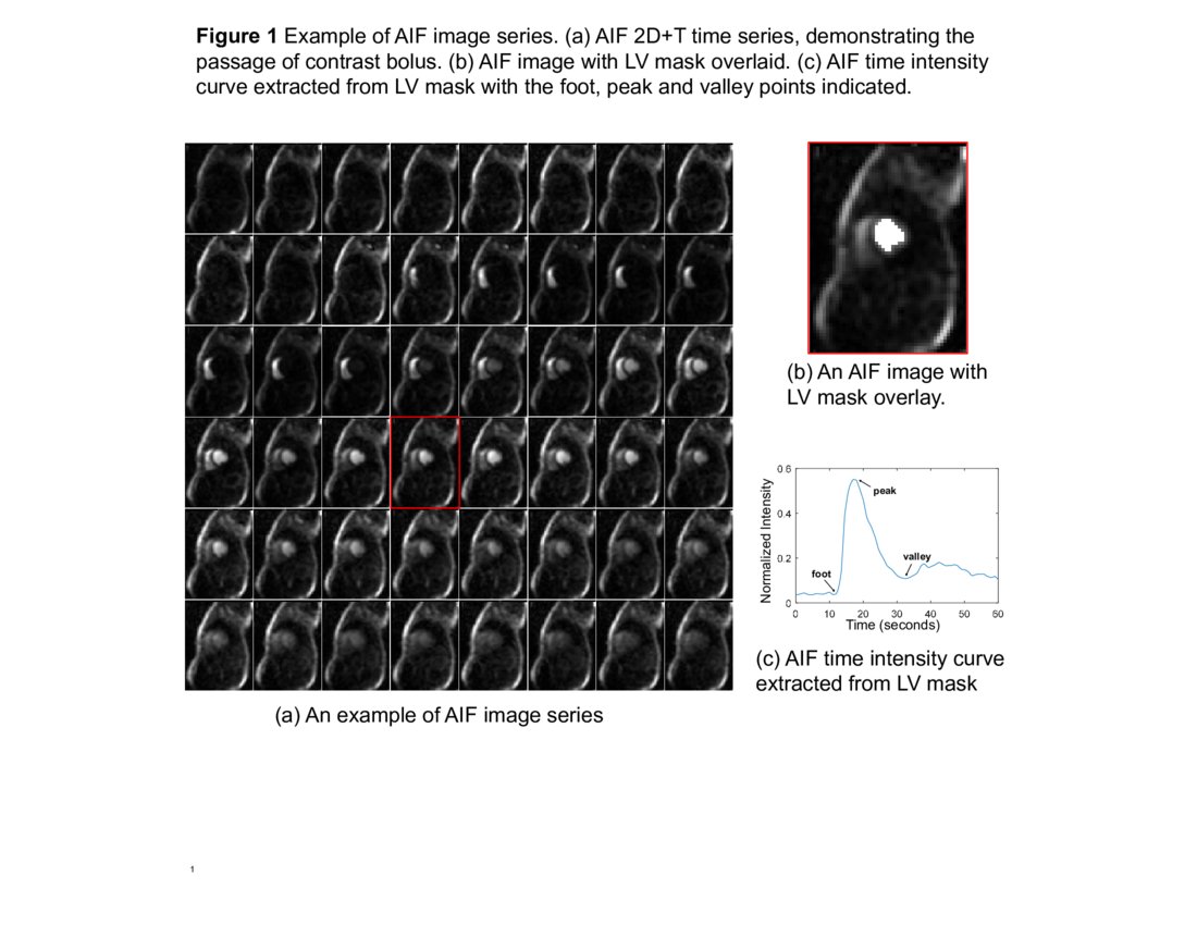Automated Detection Of Left Ventricle In Arterial Input Function Images