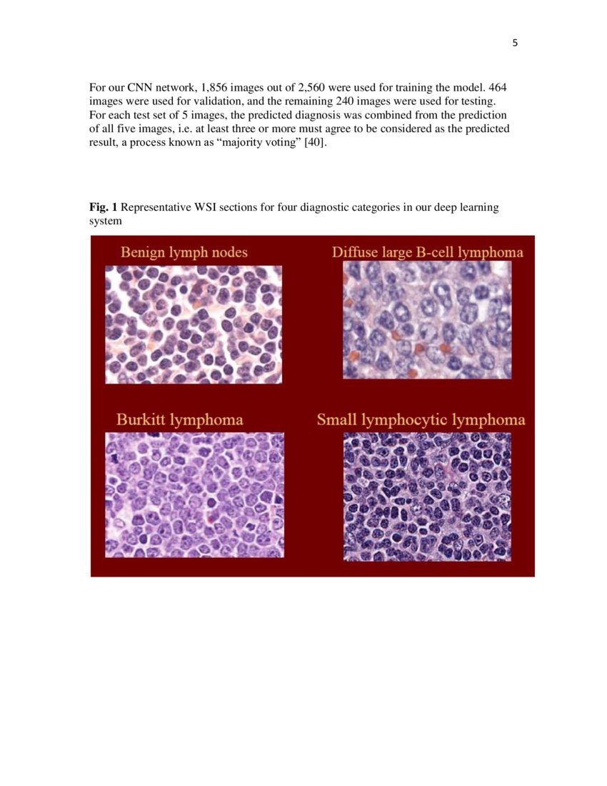 Automated Diagnosis of Lymphoma with Digital Pathology Images Using ...