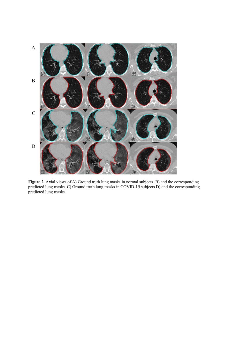 Automated lung segmentation from CT images of normal and COVID-19 pneumonia patients | DeepAI