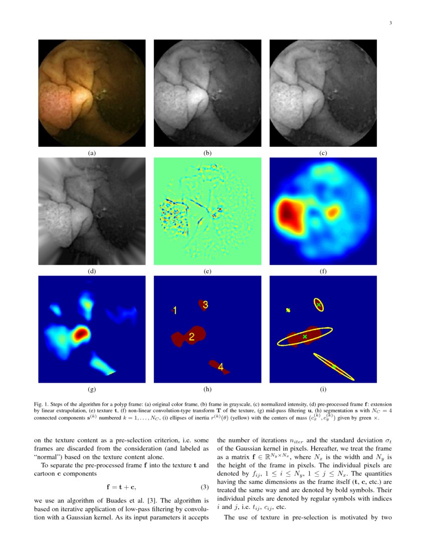Automated Polyp Detection In Colon Capsule Endoscopy Deepai