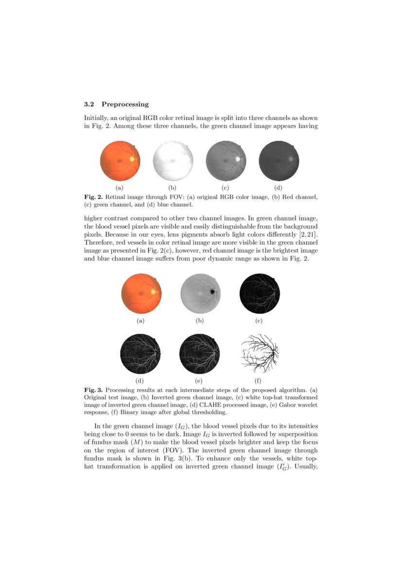 Automated Retinal Vessel Segmentation Based On Morphological Preprocessing And 2d Gabor Wavelets