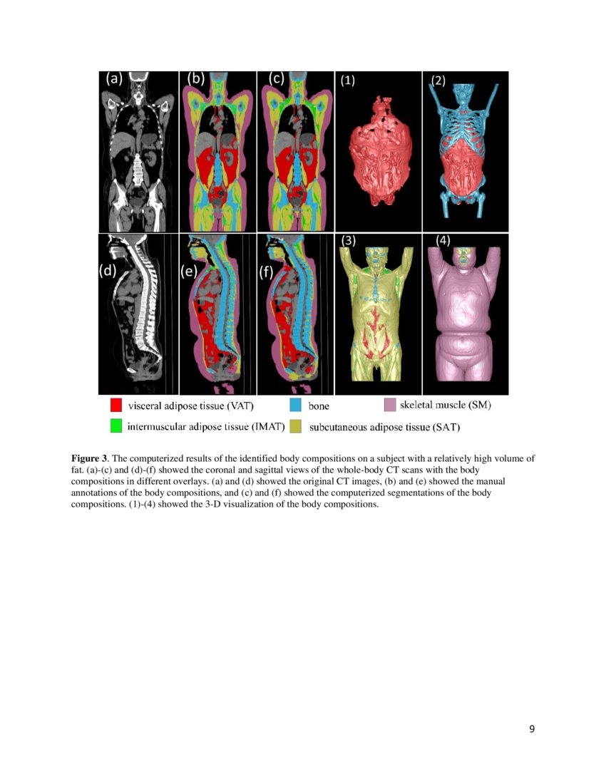 Automated Segmentation Of 3 D Body Composition On Computed Tomography Deepai