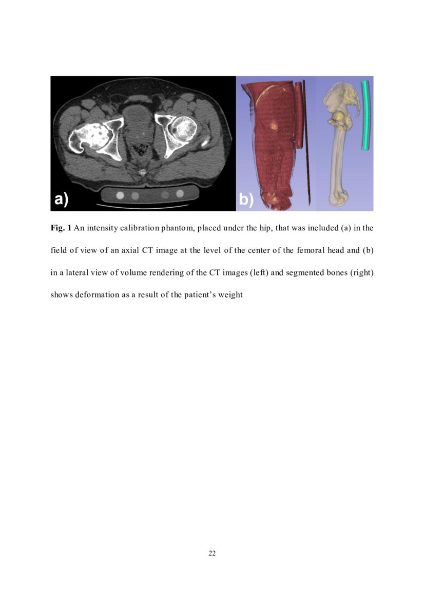 Automated Segmentation Of An Intensity Calibration Phantom In Clinical Ct Images Using A