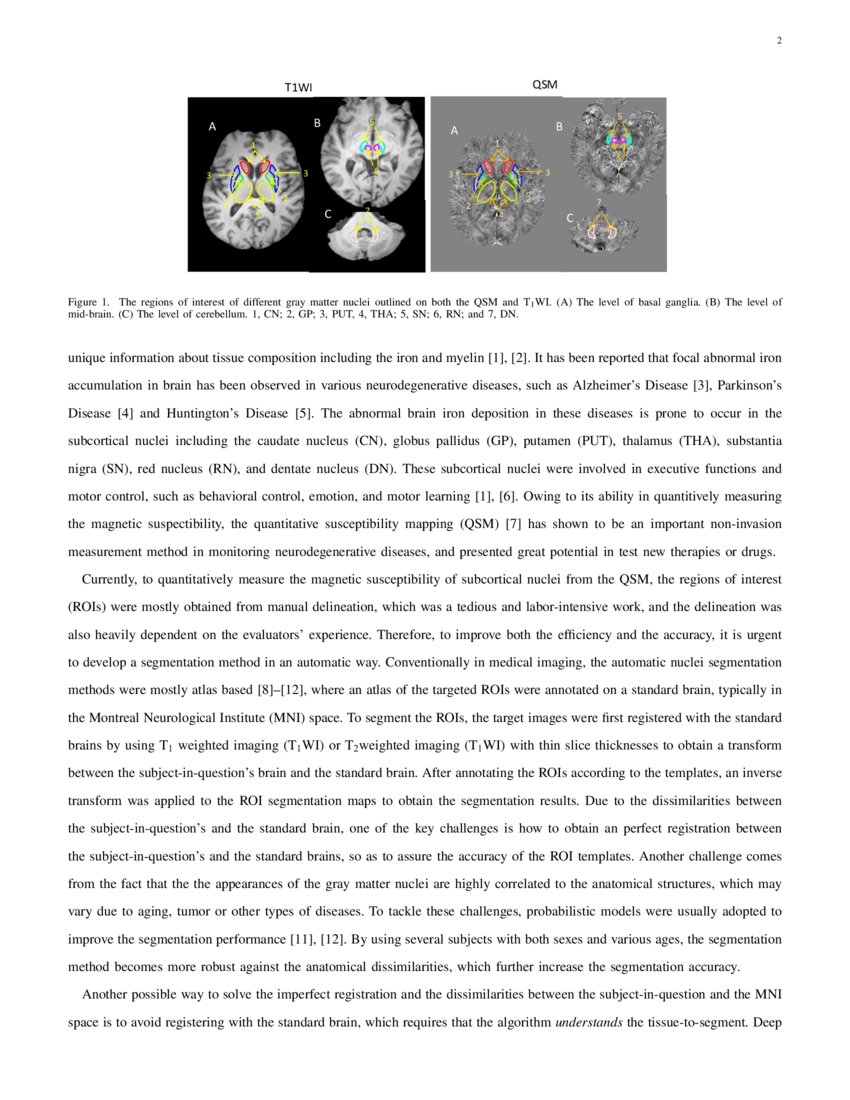 Automated Segmentation of Brain Gray Matter Nuclei on Quantitative Susceptibility Mapping Using ...