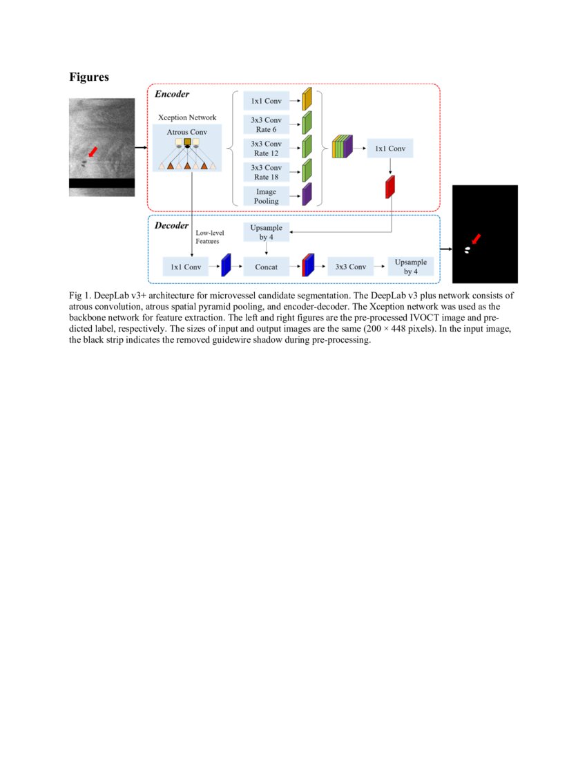 Automated Segmentation Of Microvessels In Intravascular Oct Images Using Deep Learning Deepai