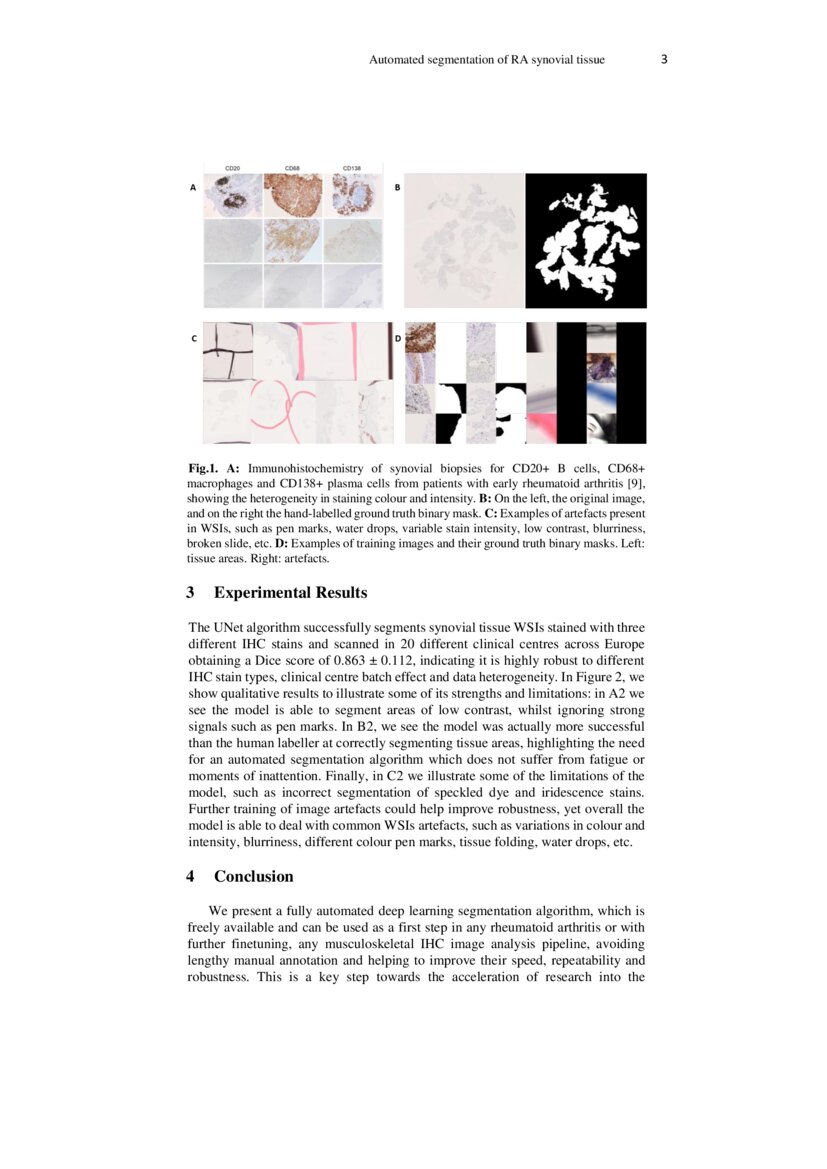 Automated Segmentation Of Rheumatoid Arthritis Immunohistochemistry 9663