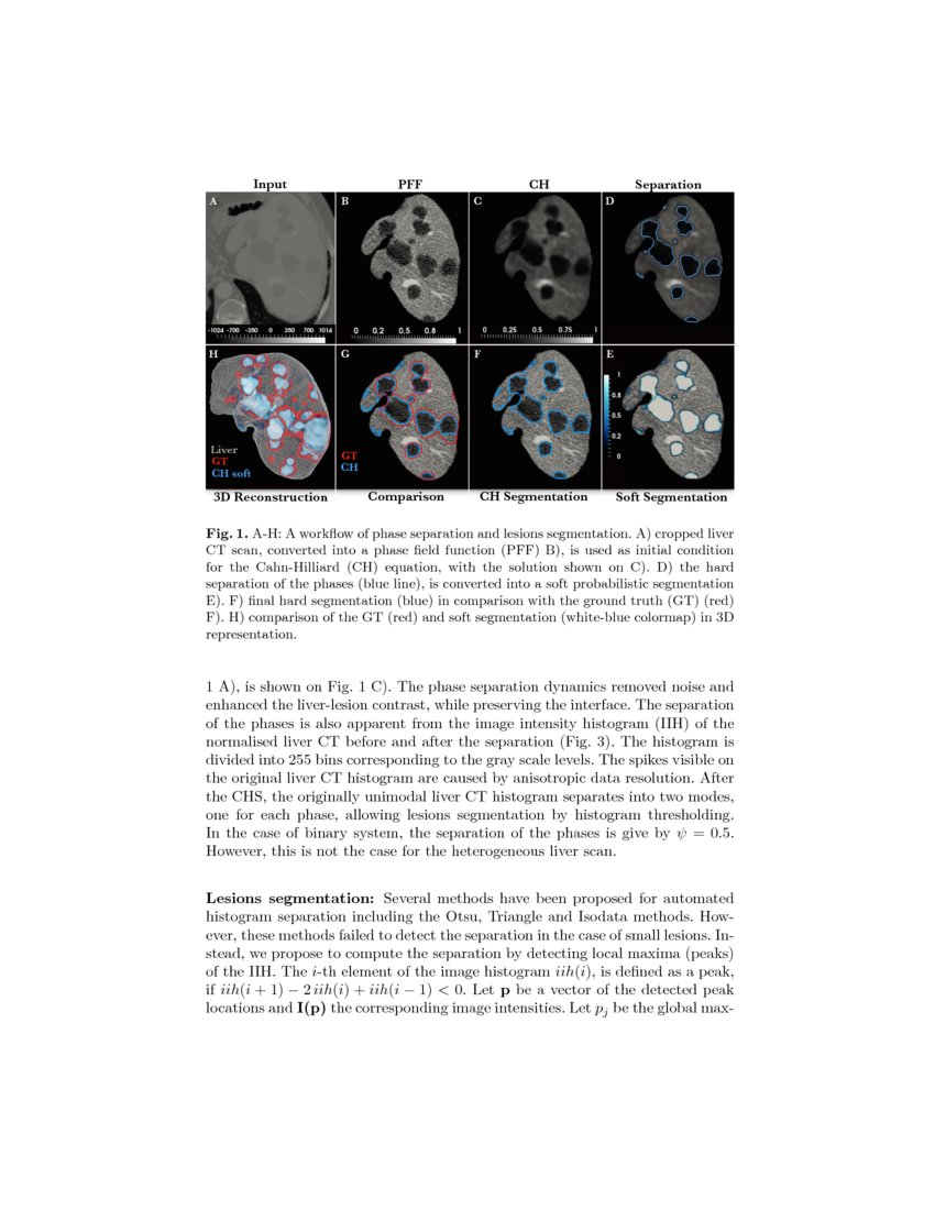 Automated Unsupervised Segmentation of Liver Lesions in CT scans via Cahn-Hilliard Phase ...