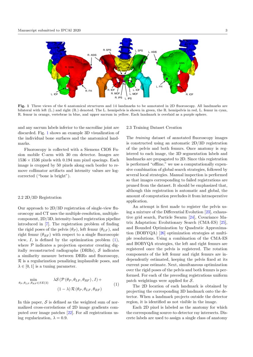 Automatic Annotation of Hip Anatomy in Fluoroscopy for Robust and ...