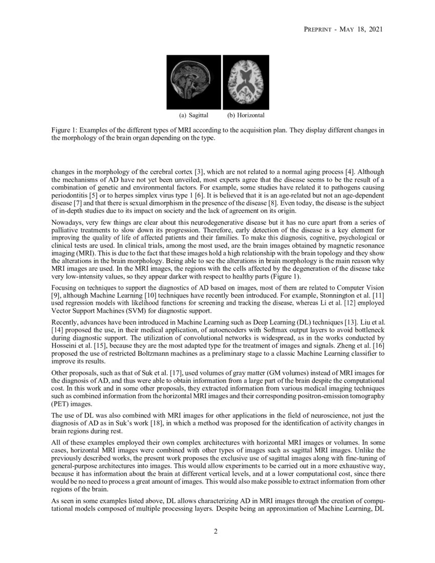 Automatic Assessment of Alzheimer's Disease Diagnosis Based on Deep ...