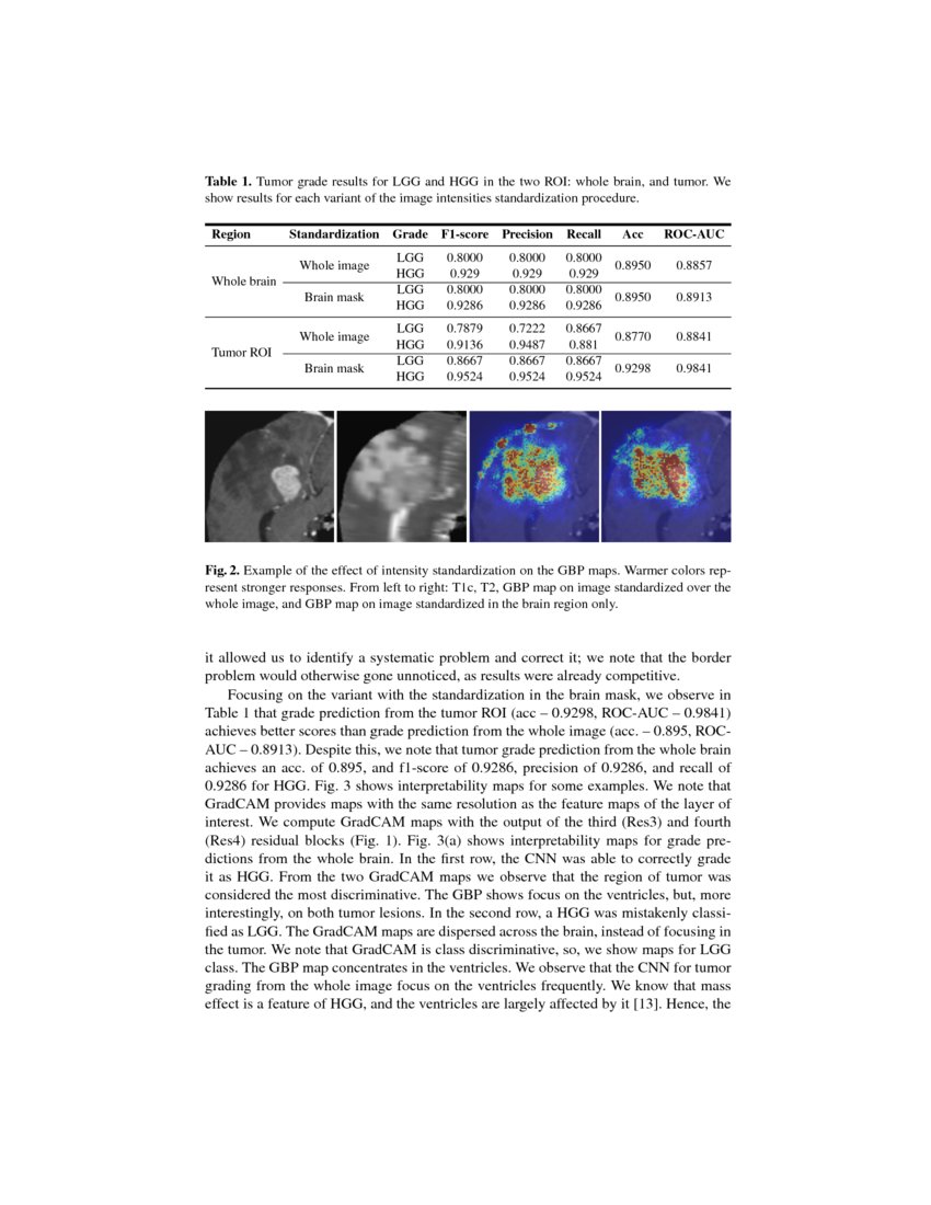 Automatic Brain Tumor Grading From Mri Data Using Convolutional Neural