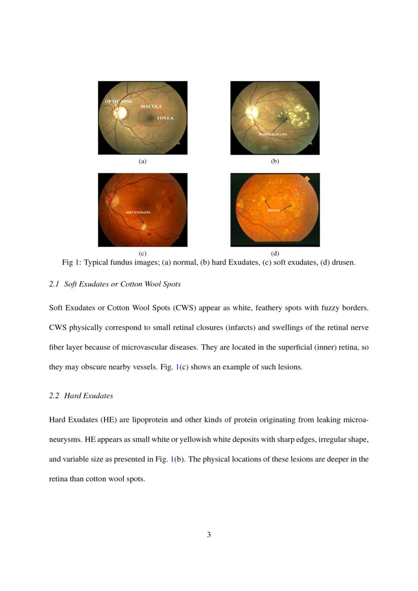 Automatic Classification of Bright Retinal Lesions via Deep Network ...