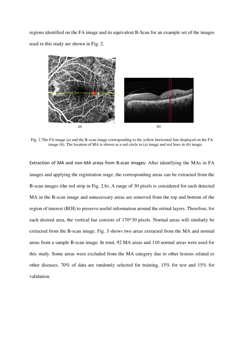 Automatic Detection Of Microaneurysms In Oct Images Using Bag Of
