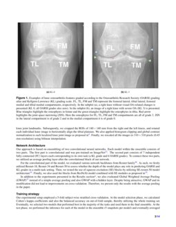 Automatic Grading of Individual Knee Osteoarthritis Features in Plain ...