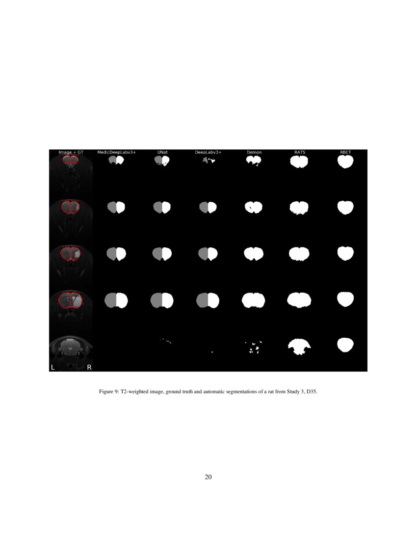 Automatic Hemisphere Segmentation In Rodent Mri With Lesions Deepai