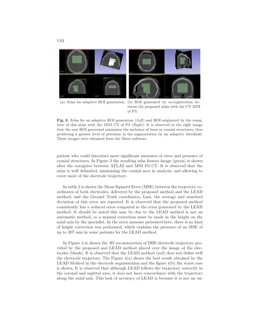 Automatic Localization of Deep Stimulation Electrodes Using Trajectory ...
