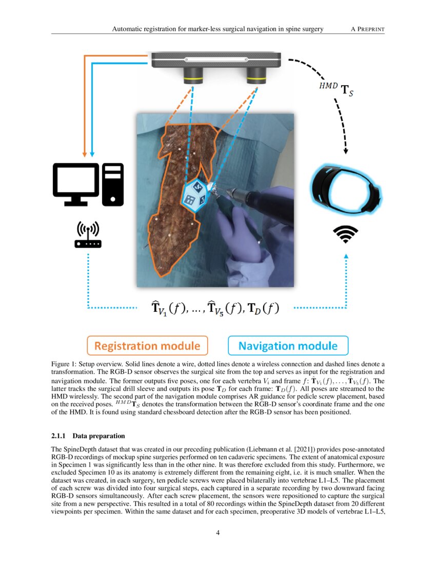 Automatic registration with continuous pose updates for marker-less ...