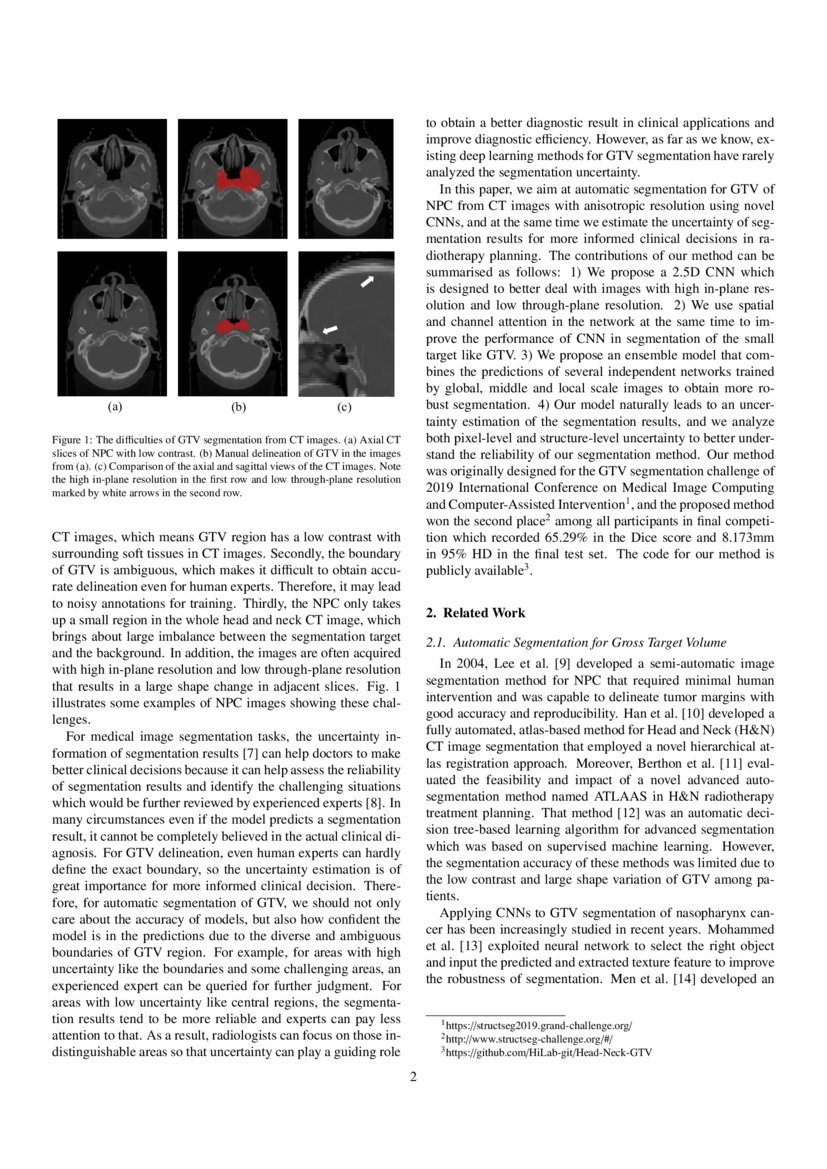 Automatic Segmentation of Gross Target Volume of Nasopharynx Cancer ...