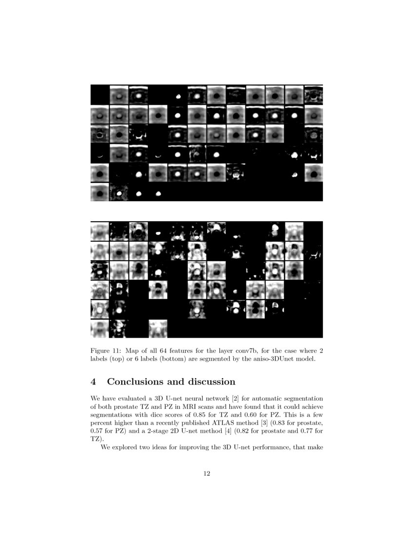 Automatic segmentation of prostate zones | DeepAI