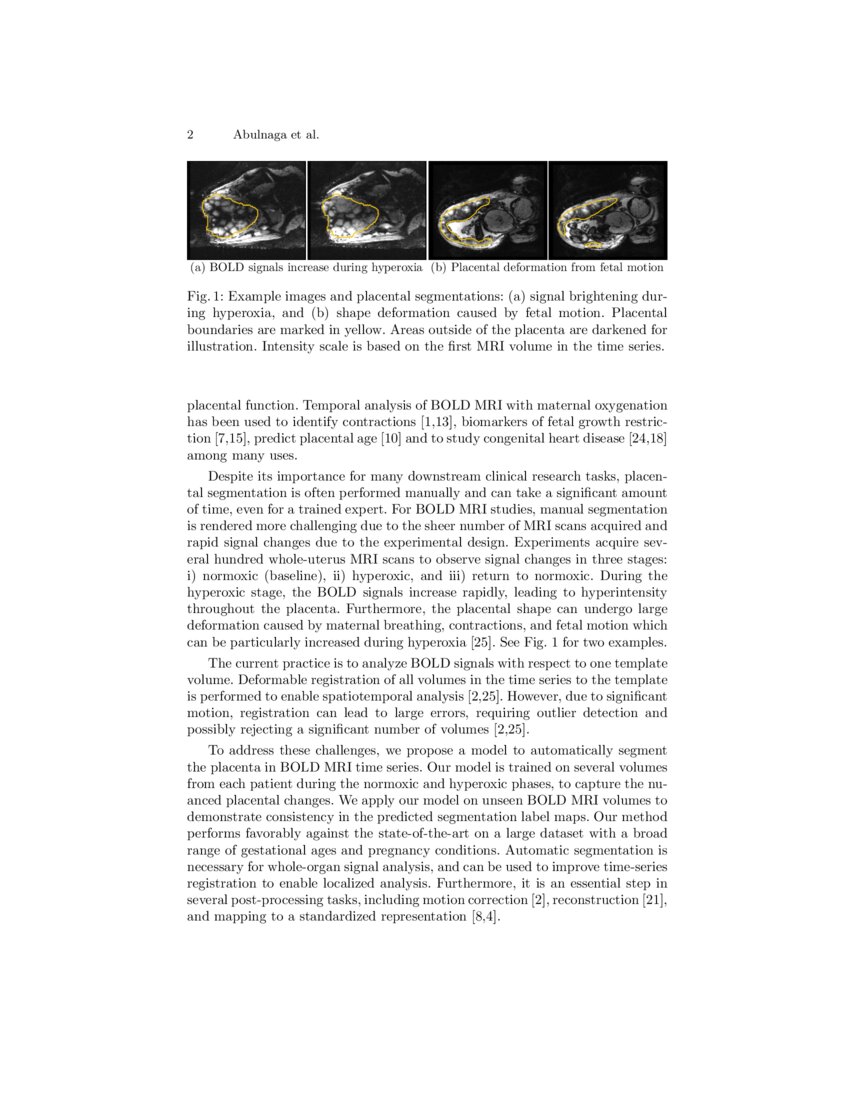 Automatic Segmentation of the Placenta in BOLD MRI Time Series | DeepAI