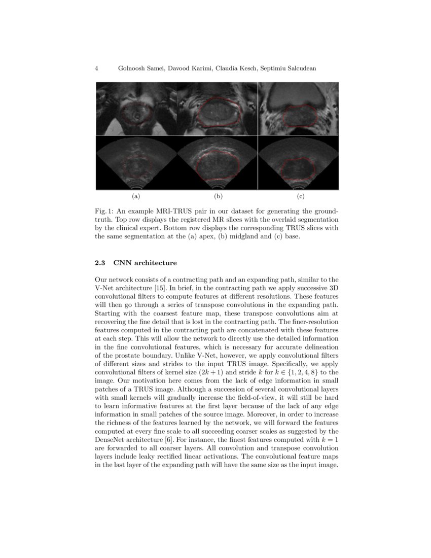 Automatic Segmentation Of The Prostate On 3d Trans Rectal Ultrasound