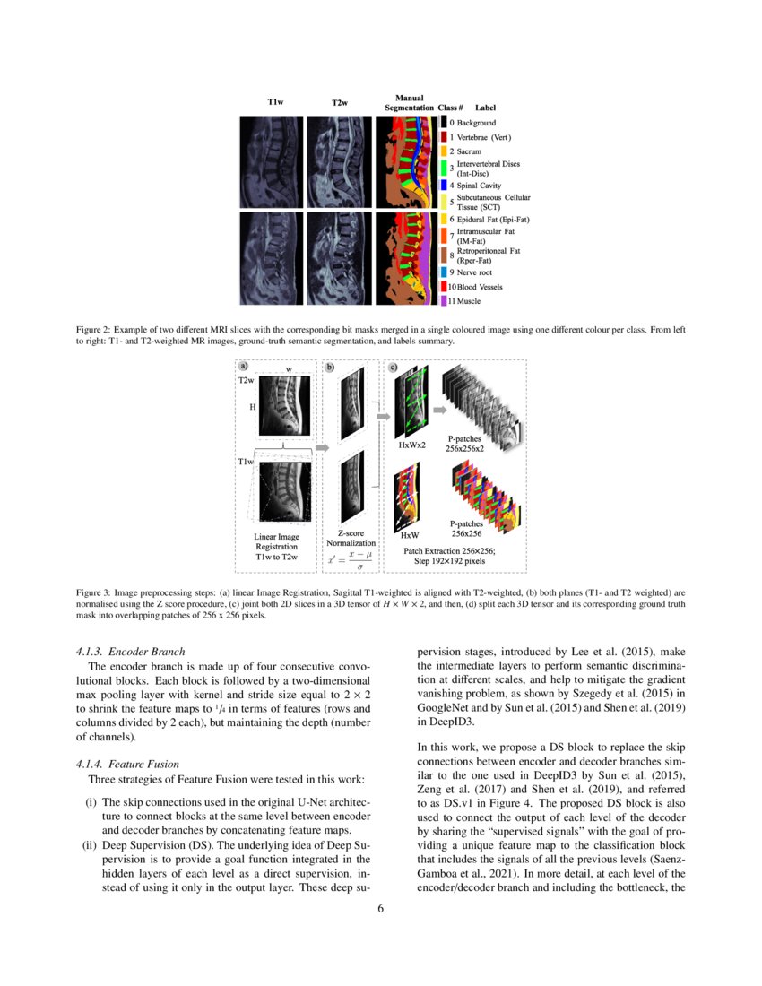 Automatic Semantic Segmentation Of The Lumbar Spine Clinical Applicability In A Multi