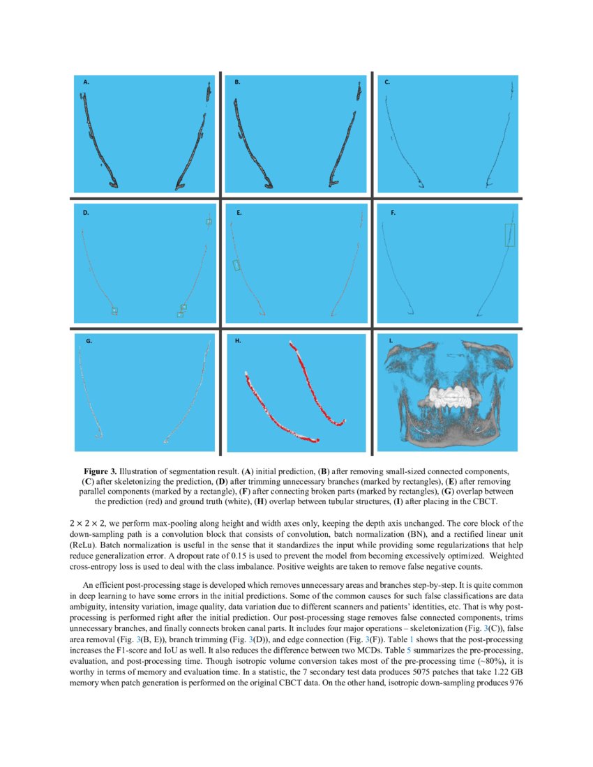 Automatic Tracing Of Mandibular Canal Pathways Using Deep Learning Deepai