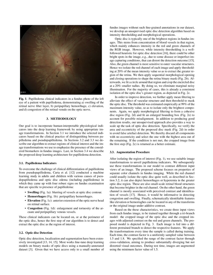 Automating Detection of Papilledema in Pediatric Fundus Images with ...