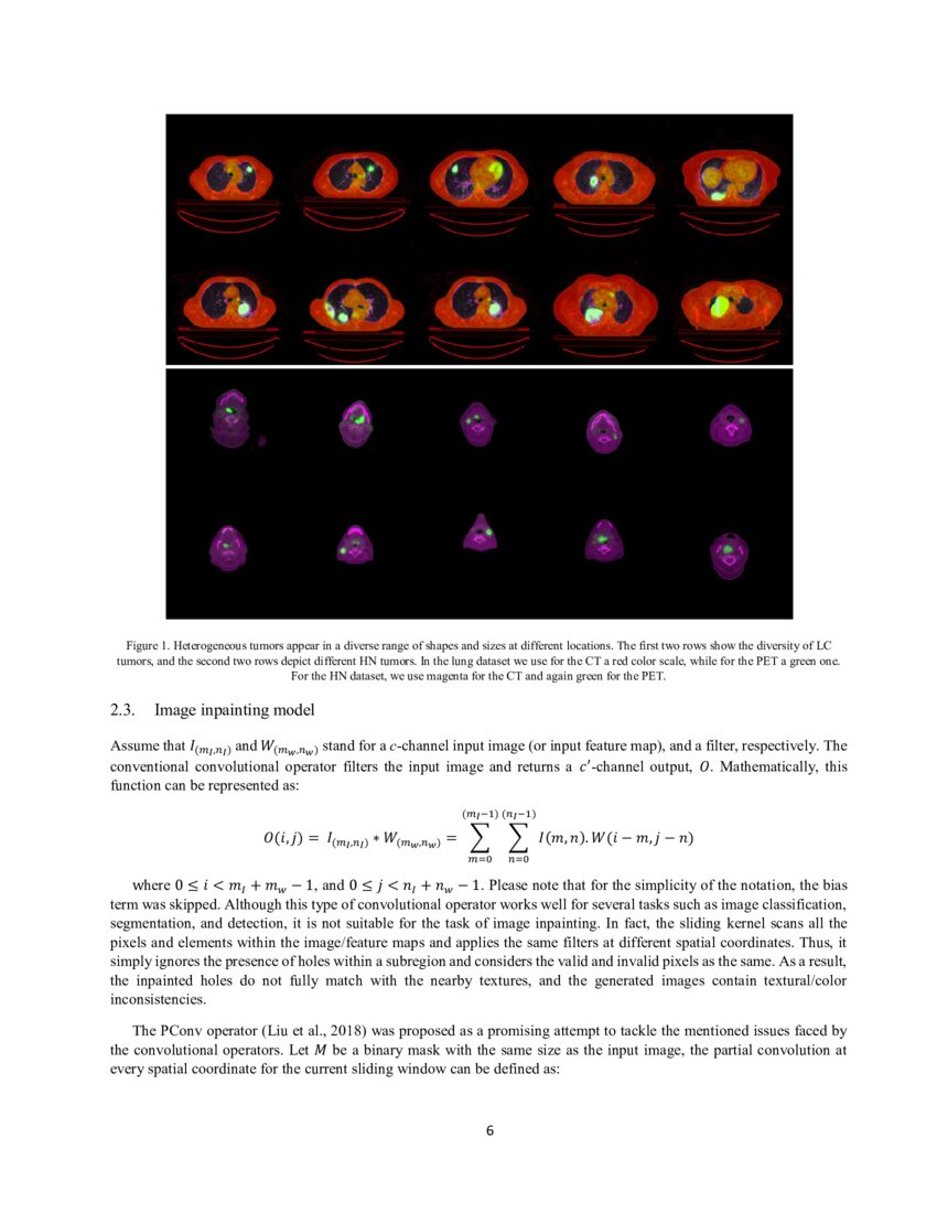AutoPaint: A Self-Inpainting Method for Unsupervised Anomaly Detection | DeepAI