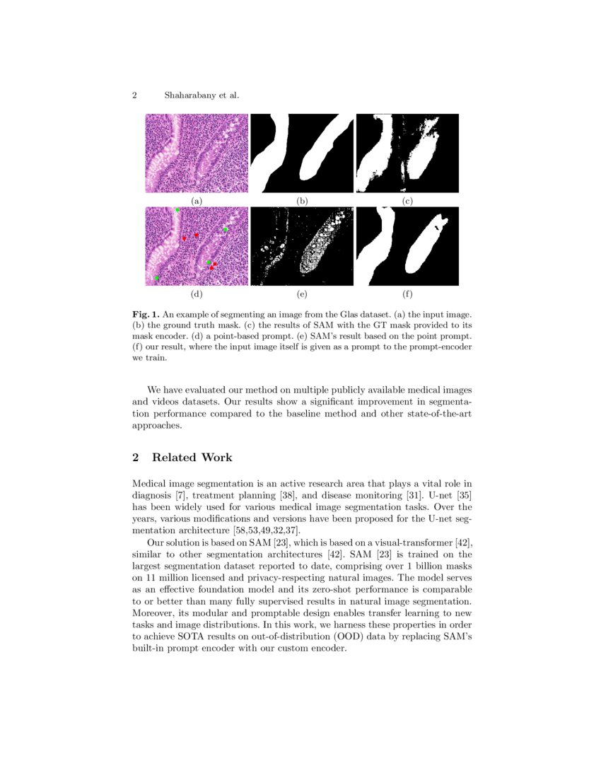 AutoSAM: Adapting SAM to Medical Images by Overloading the Prompt ...