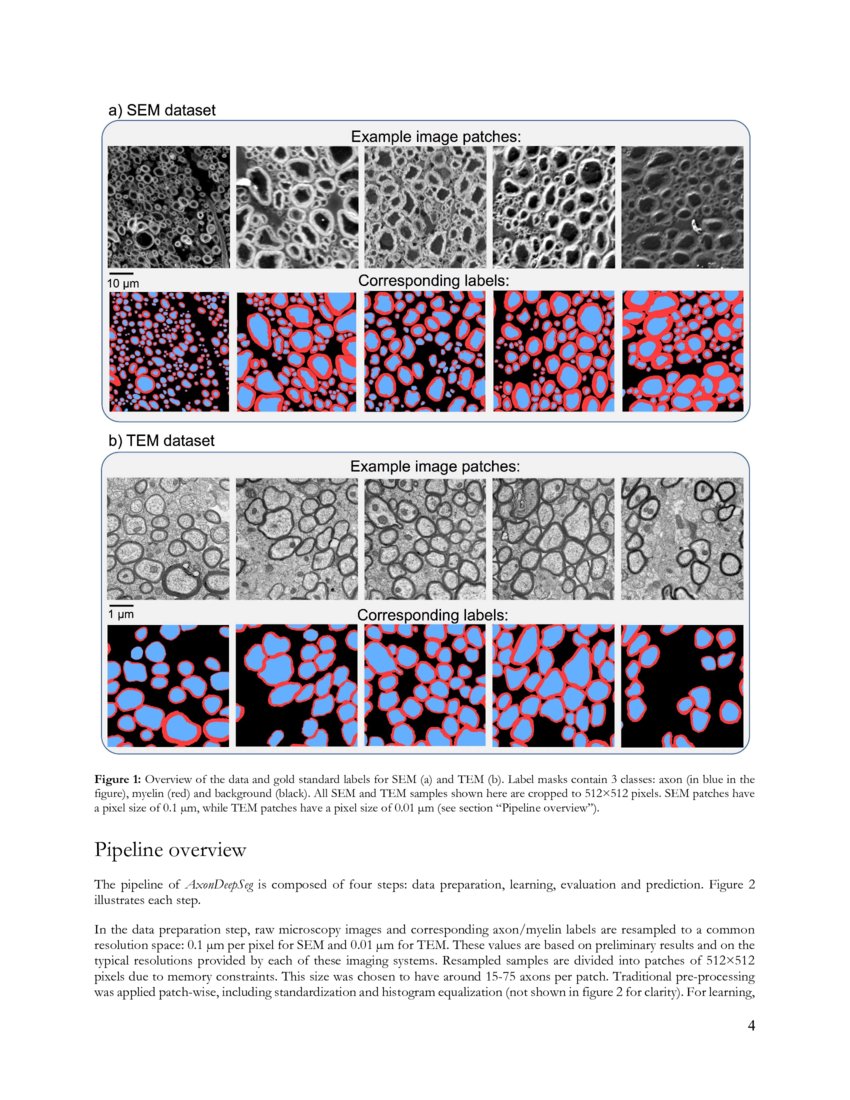 AxonDeepSeg: automatic axon and myelin segmentation from microscopy data using convolutional ...