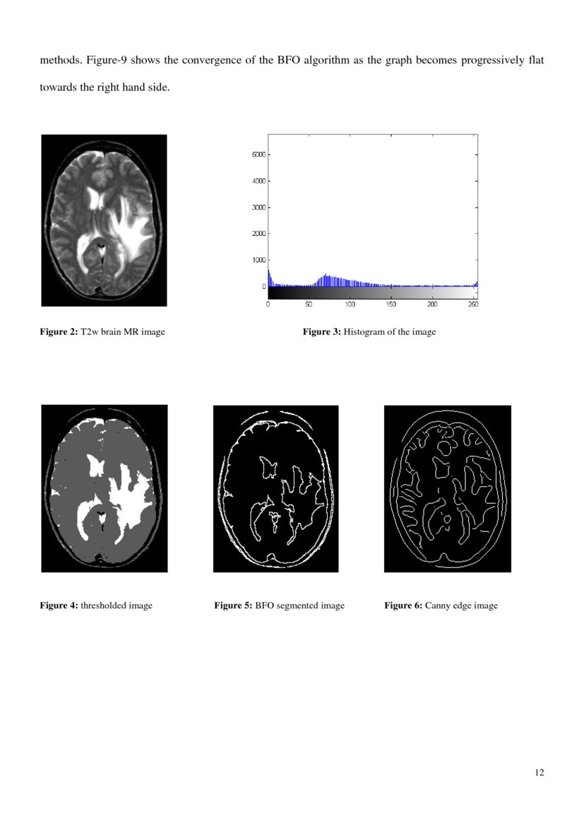 Bacterial Foraging Optimization Based Brain Magnetic Resonance Image Segmentation Deepai