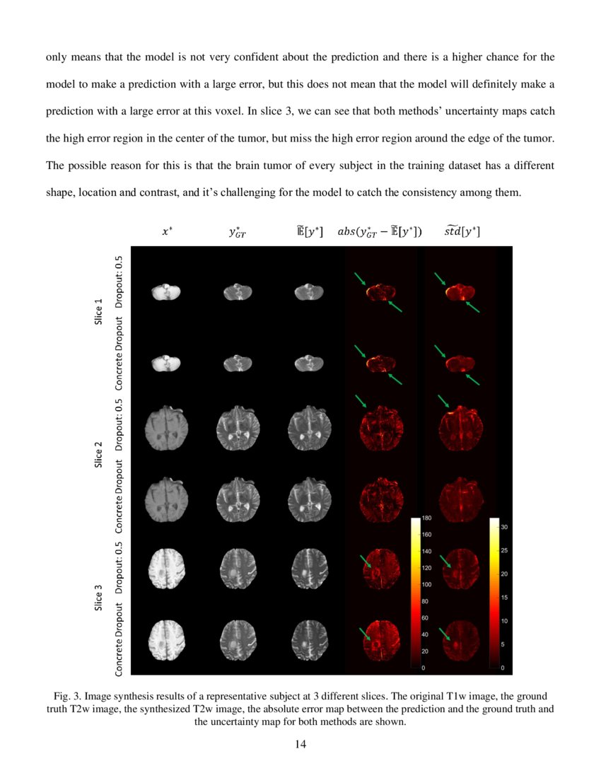 Bayesian Conditional GAN for MRI Brain Image Synthesis | DeepAI