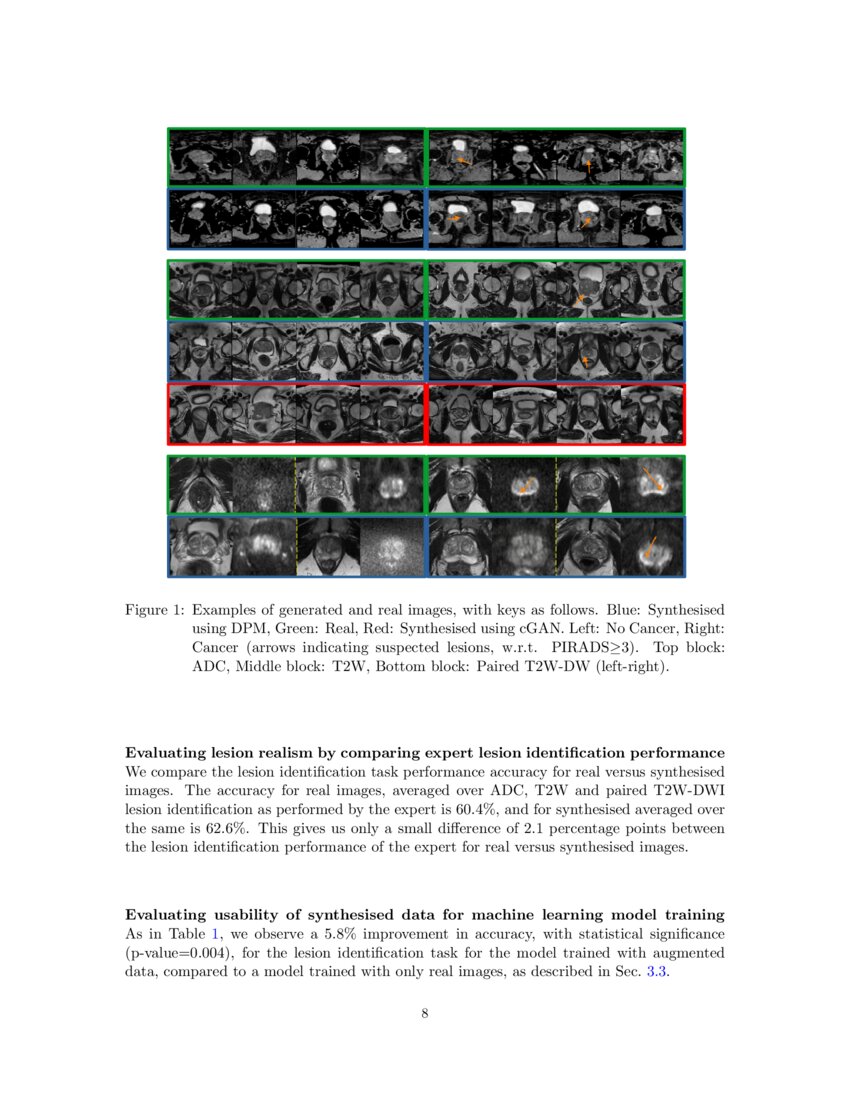 Bi-parametric prostate MR image synthesis using pathology and sequence-conditioned stable ...