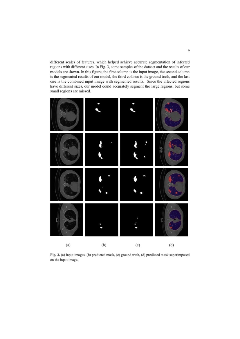 Bifurcated Autoencoder for Segmentation of COVID-19 Infected Regions in ...