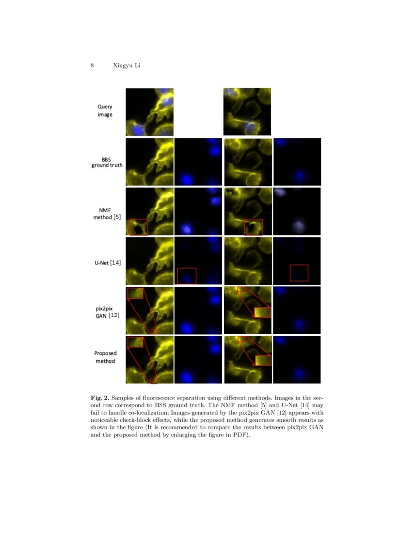 Blind stain separation using model-aware generative learning and its ...