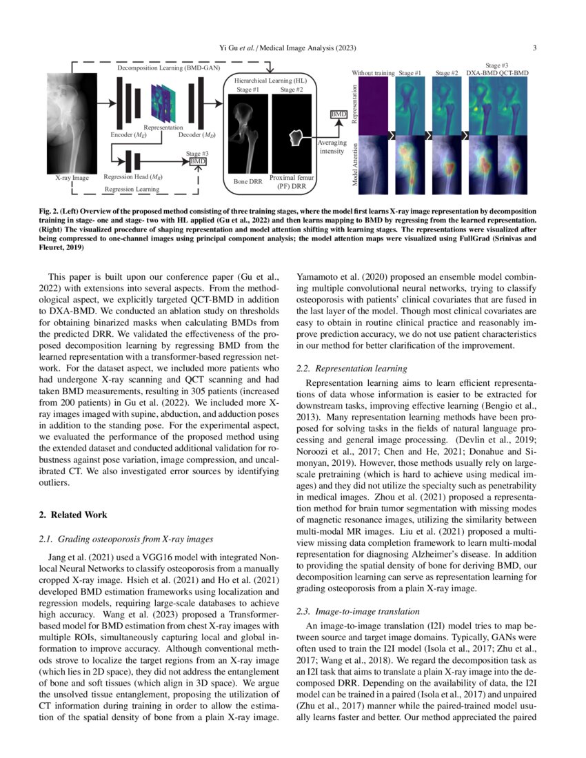 Bone mineral density estimation from a plain X-ray image by learning decomposition into ...