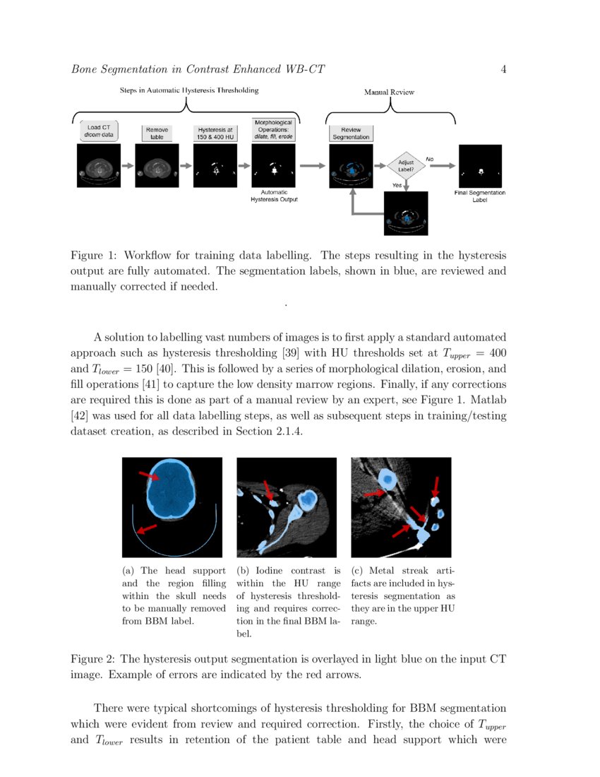 Bone Segmentation In Contrast Enhanced Whole Body Computed Tomography