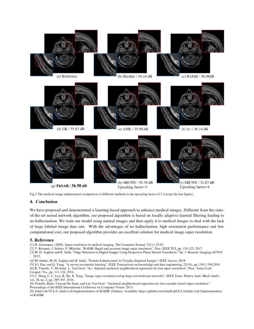 Brain MRI Image Super Resolution using Phase Stretch Transform and ...