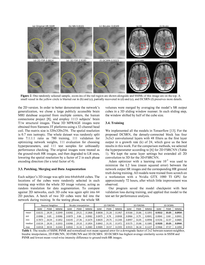 Brain Mri Super Resolution Using 3d Deep Densely Connected Neural Networks Deepai