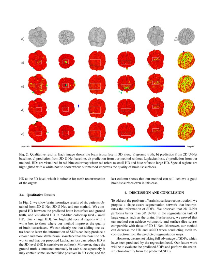 Brain Surface Reconstruction from MRI Images Based on Segmentation ...