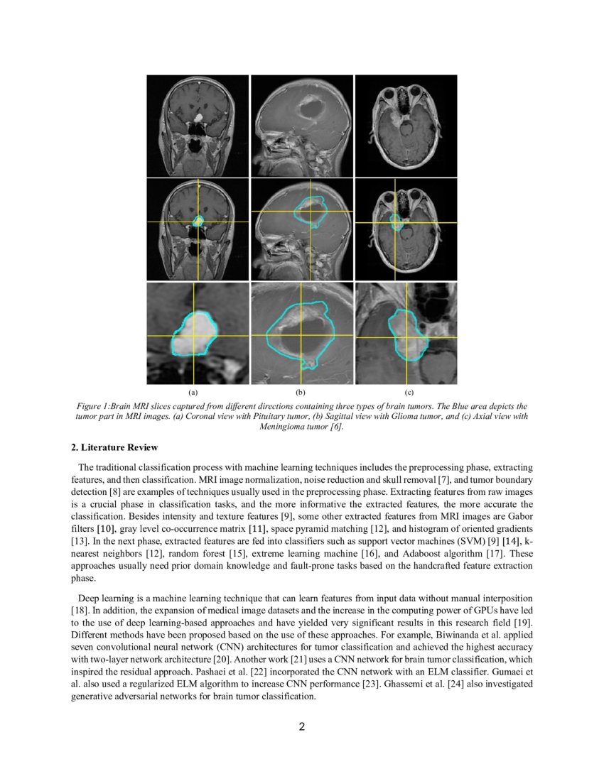 Brain Tumor Classification By Cascaded Multiscale Multitask Learning Framework Based On Feature