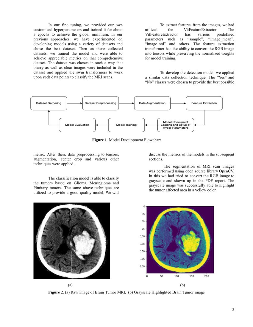 Brain Tumor Detection Using Swin Transformers Deepai